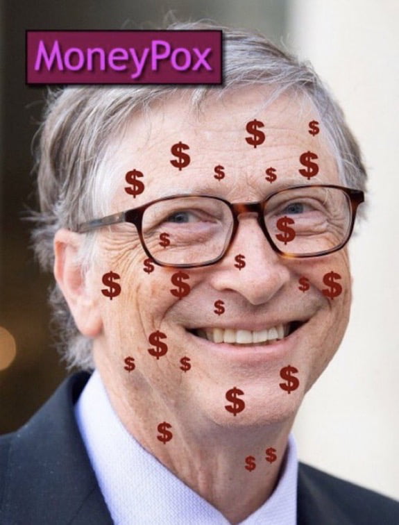 Money pox - 9GAG