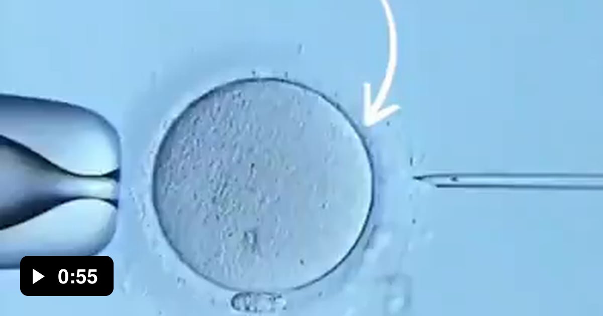 Intracytoplasmic sperm injection - 9GAG