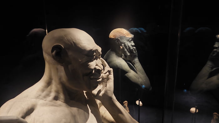 A skull fragment of the first discovered homo erectus fossil arranged ...