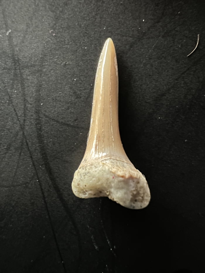 What kind of tooth is that ? Thx - 9GAG