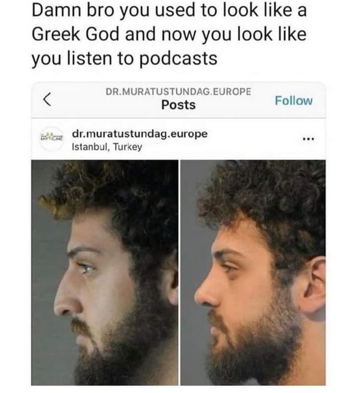 Nose Job fail. - 9GAG