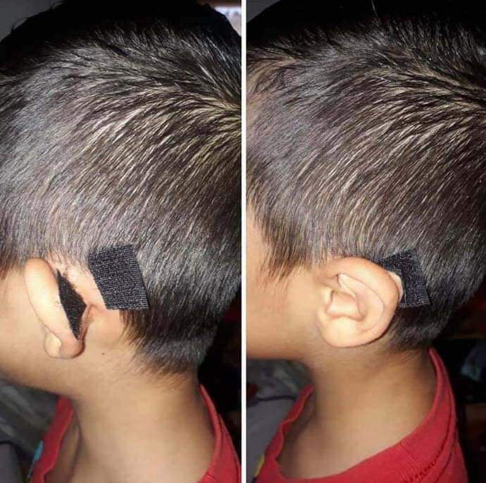 Velcro fixes anything... - 9GAG