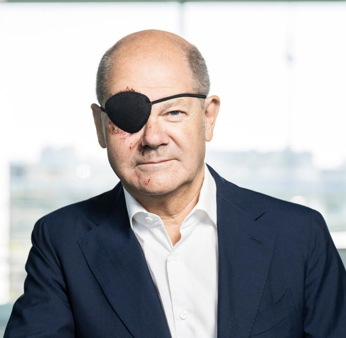 Chancellor of Germany wearing eye patch now. New super villain in ...