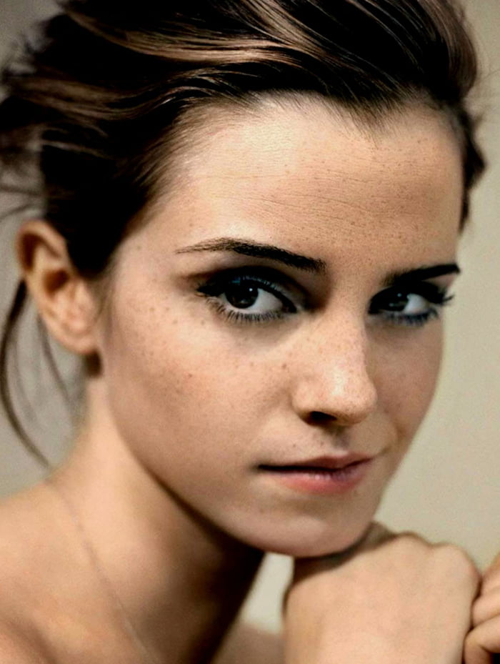 Emma, dem freckles - 9GAG
