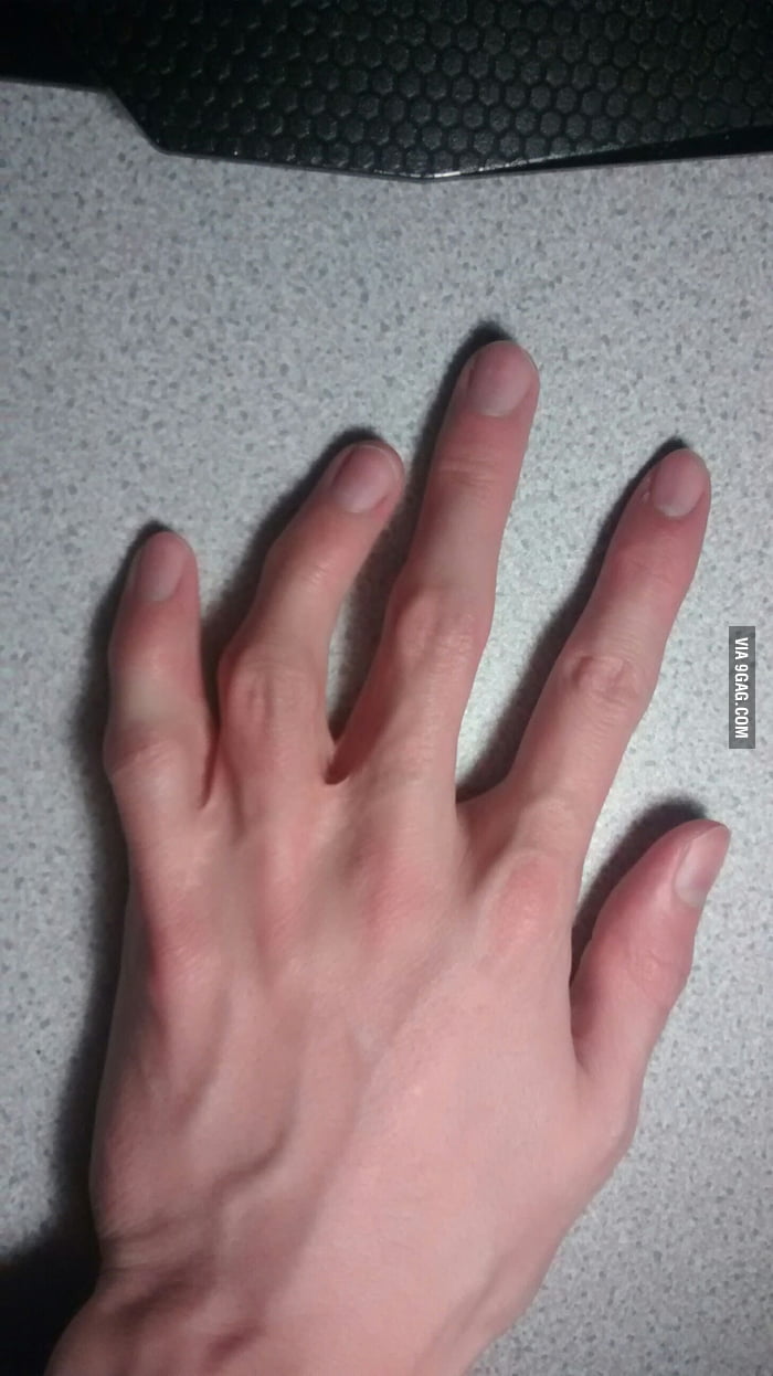 To the person with the webbed fingers. (mine were cut back but bonus ...