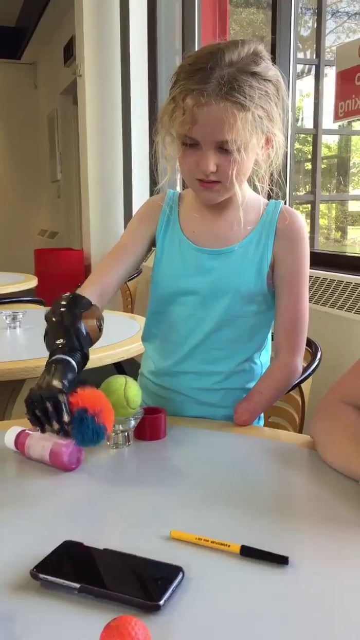 8 year old Tilly's first couple of seconds wearing a bionic hand. - 9GAG