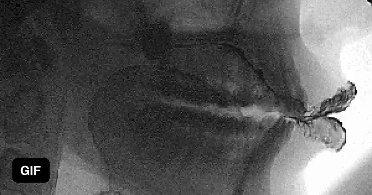 X-Ray video of moving jaw - 9GAG