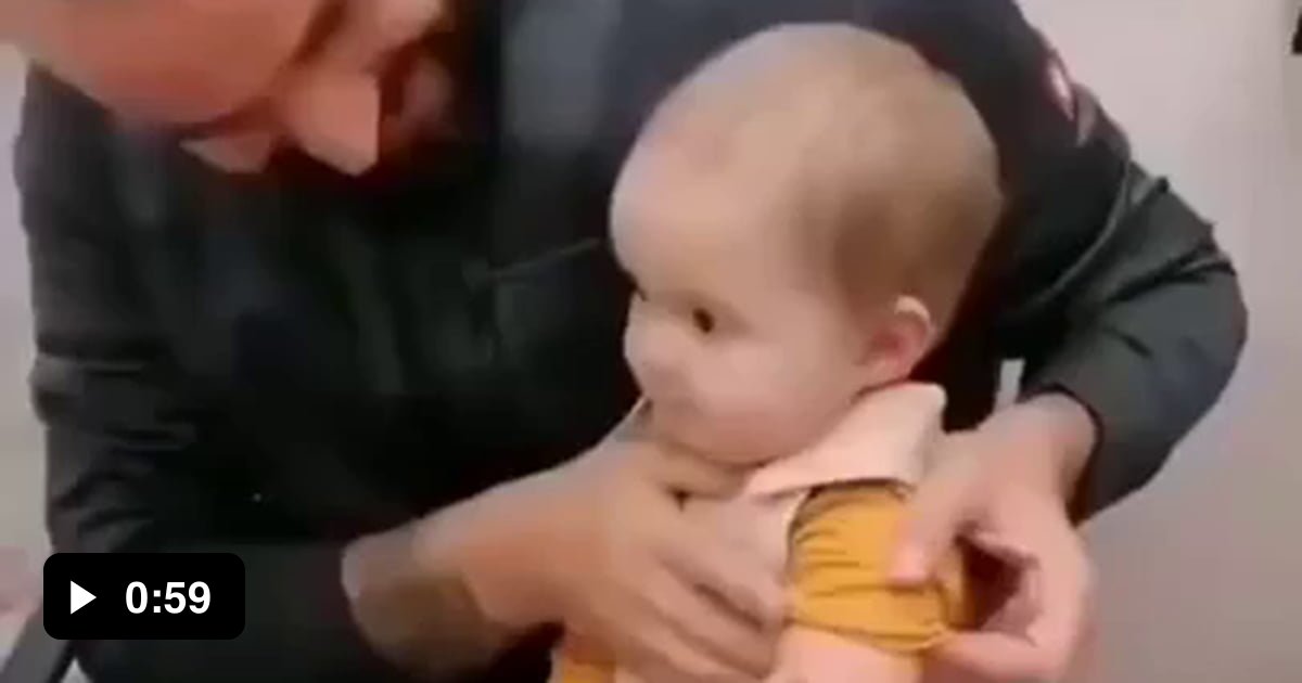 Baby Reacts To First Prosthetic Arm... - 9GAG
