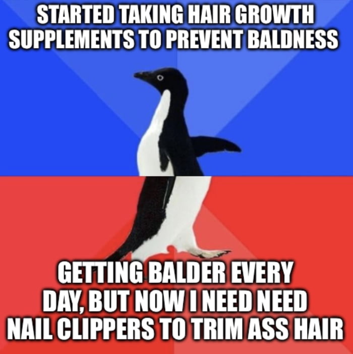 True story… Becoming chrome dome… - 9GAG