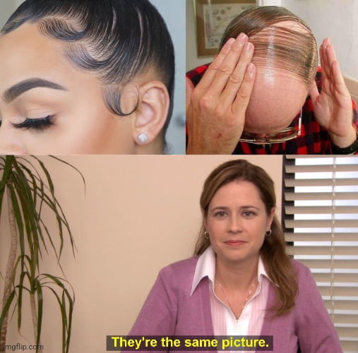 Why does black trashy girls only do this? Are they going bald? - 9GAG