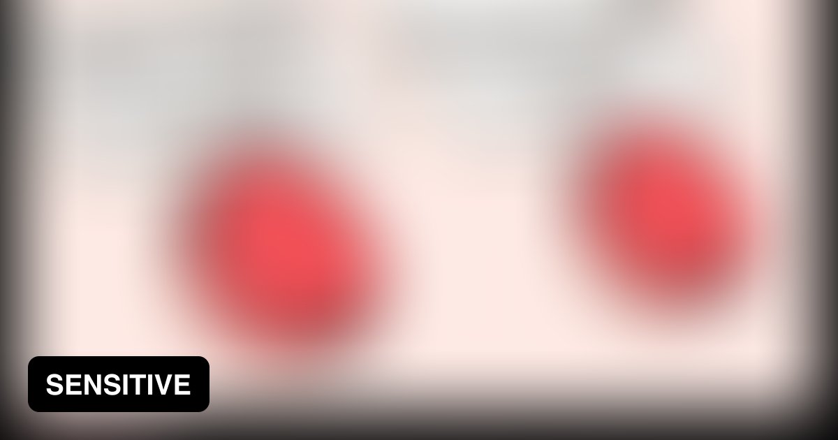 *proceeds to press both buttons - 9GAG