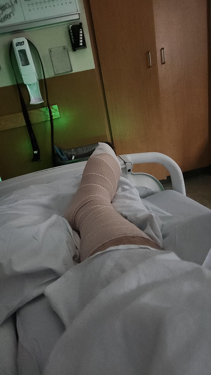 Went too cut the lawn, but ended up cutting off 2 toes - 9GAG