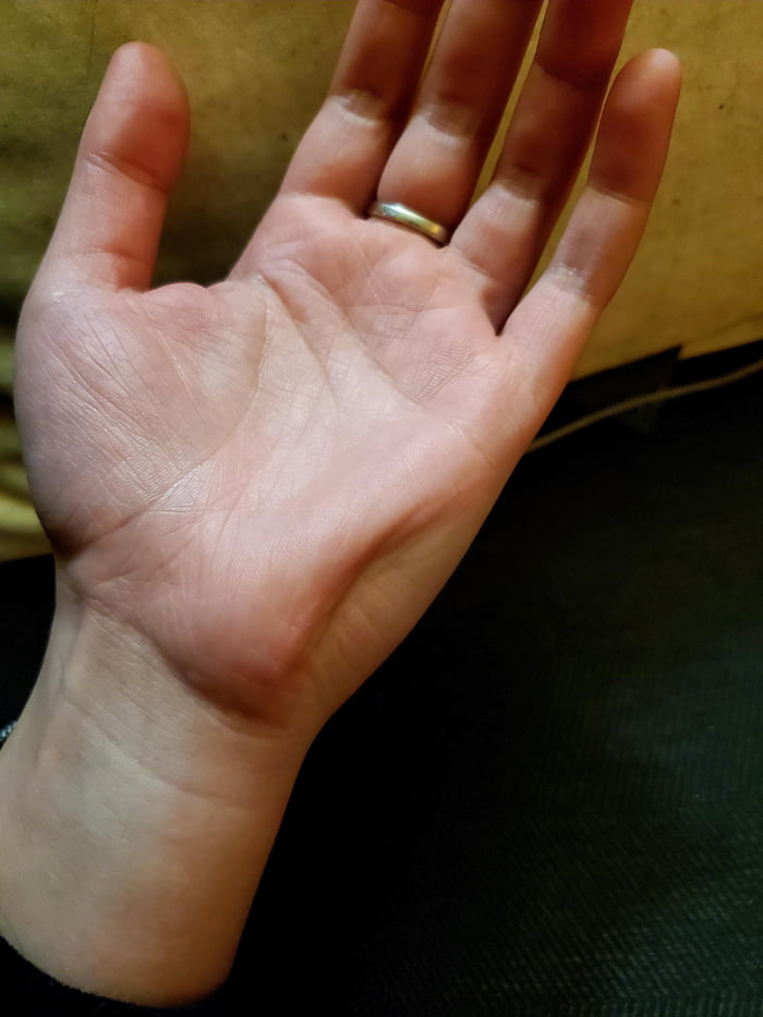 What a cramp in the side of your hand looks like - 9GAG