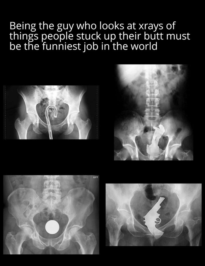 "To infinity and... beyond?" - 9GAG