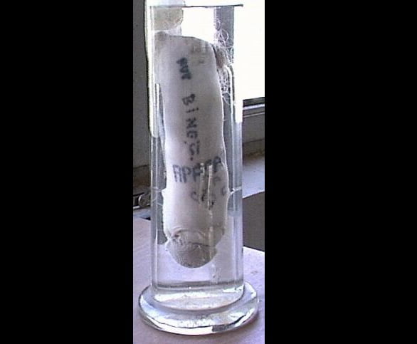 "Terente" who lived between 1895/1896 (Romania) , it is known for his ...