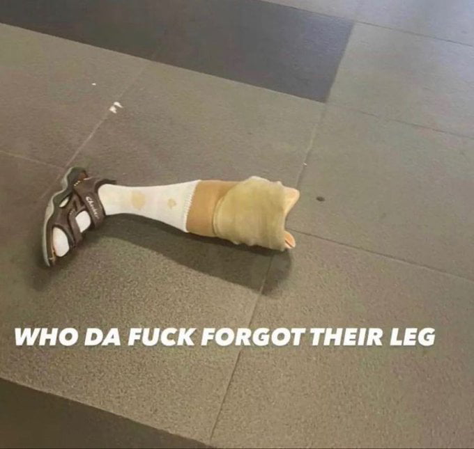 Guess someone’s taking 'break a leg' too seriously. - 9GAG