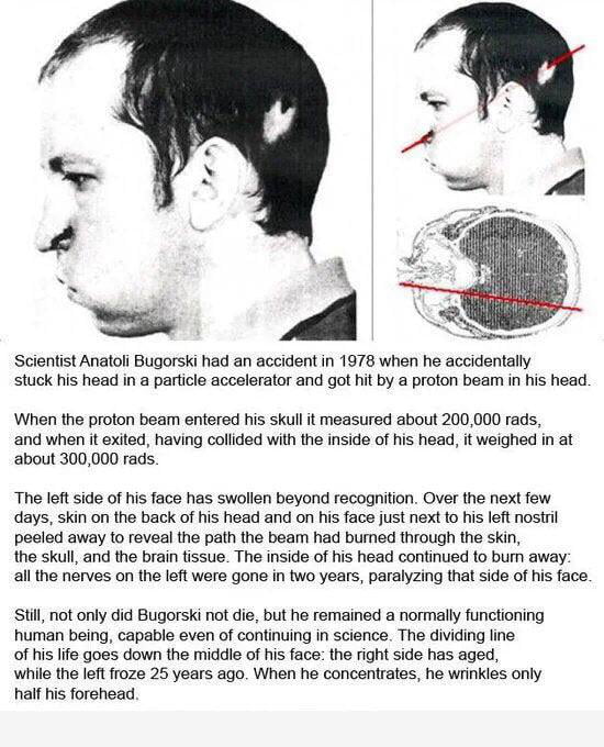 In 1978, Scientist Anatoli Bugorsky accidentally put his head in a ...