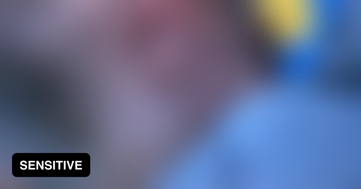 Celtic keeper Joe Hart has his scalp stapled after taking studs to the ...