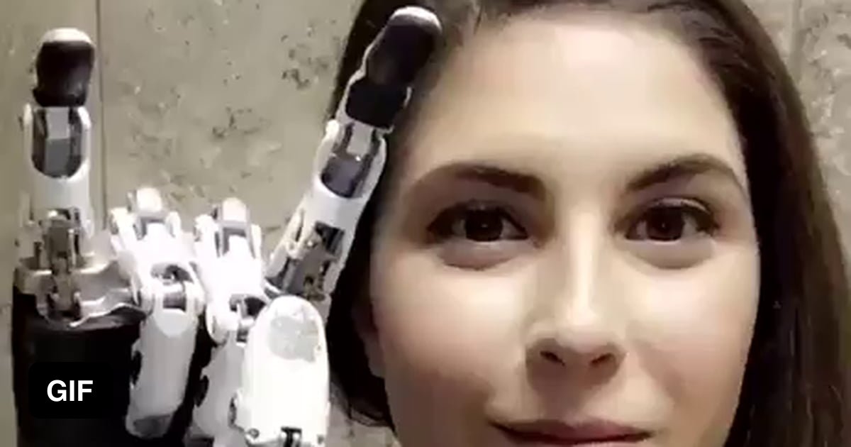 When your lost your hand but metal is life - 9GAG