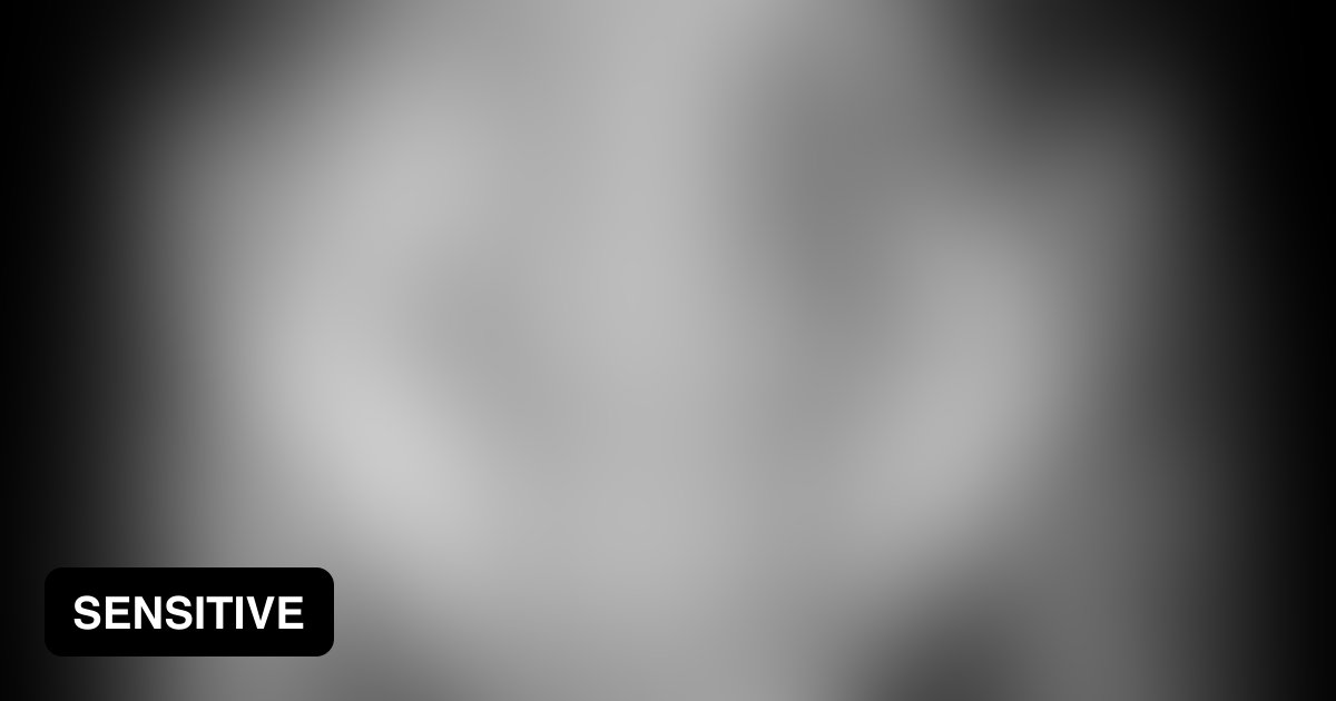 Did you Know about the "John Thomas sign"? Read in the comments! - 9GAG