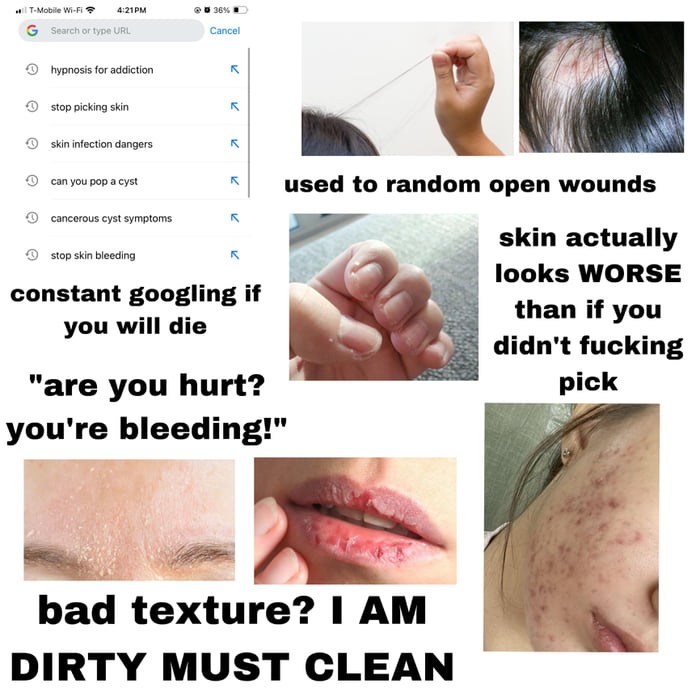 Actual, non-cute OCD starter pack - 9GAG