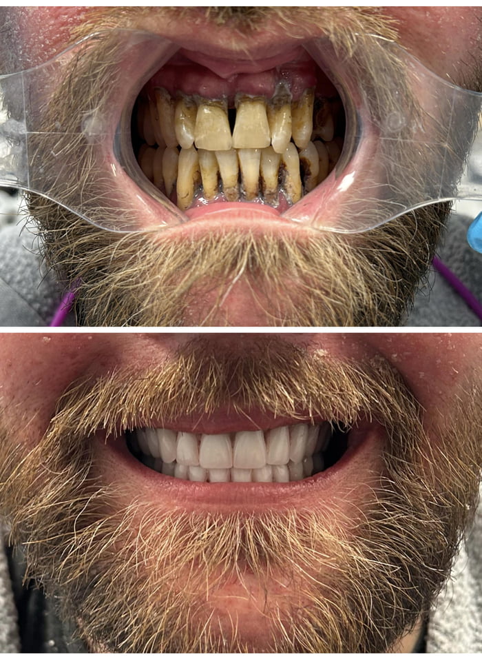 Brand new fixed smile in a day - 9GAG