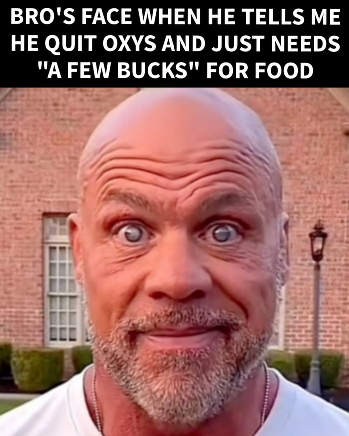 Cool bro! Congrats! Follow up question: where are your pupils? - 9GAG