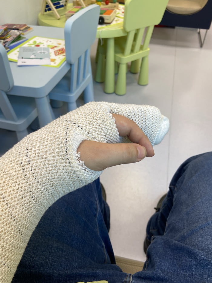 Got my pinky sinew cut. I will undergo a surgery to attach it back. F ...