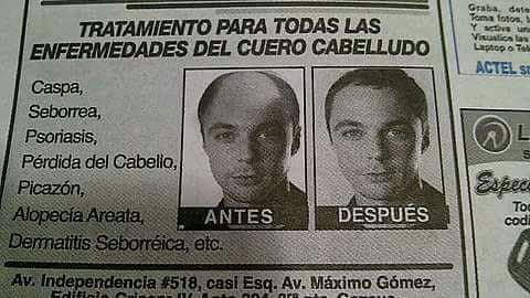 I didn't know Sheldon was bald - 9GAG