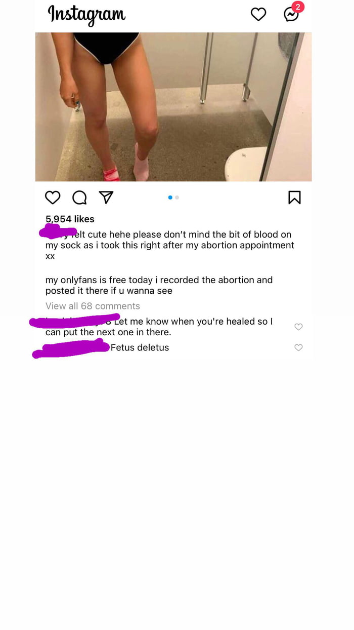 Woman advertises her abortion on Only Fans - 9GAG