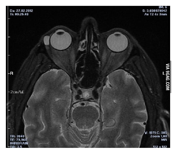 I present to you: Derp Brain - 9GAG