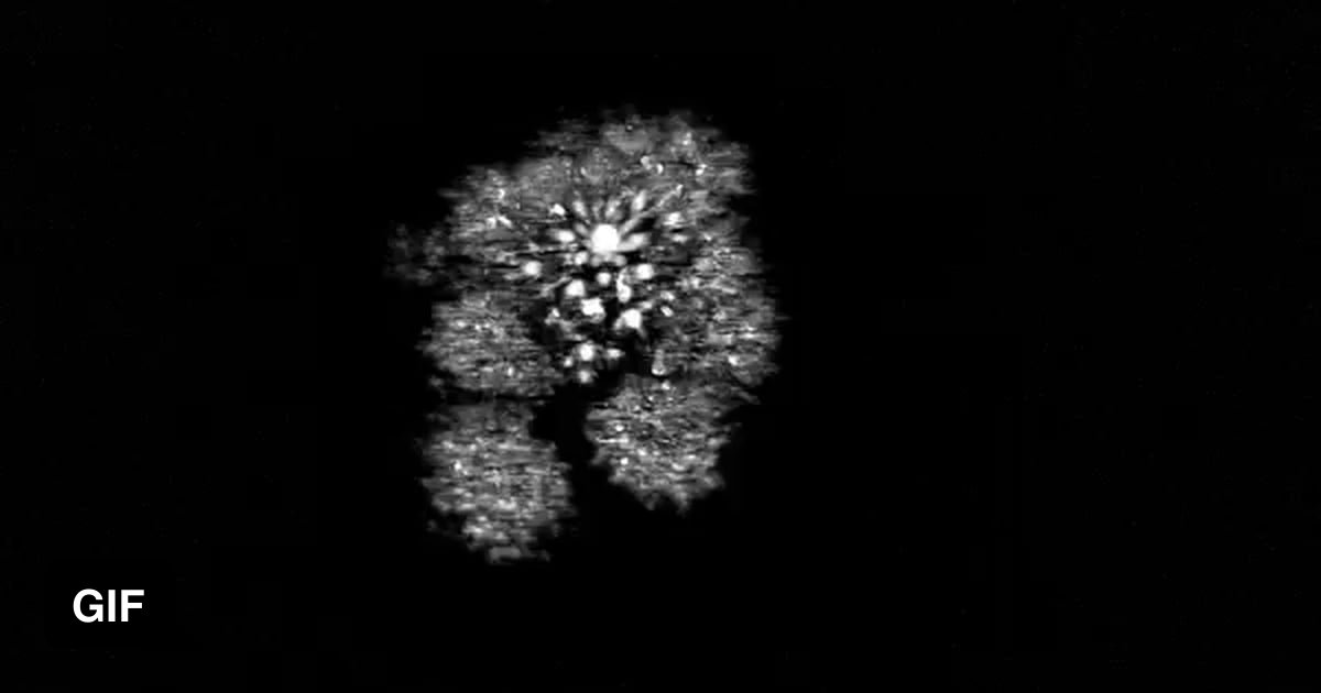 MRI Scan of a Broccoli - 9GAG