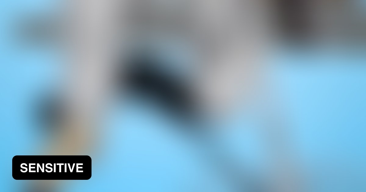 Man Survives Iron Rod Through The Head in 1848. Credit : Zack D Film's ...