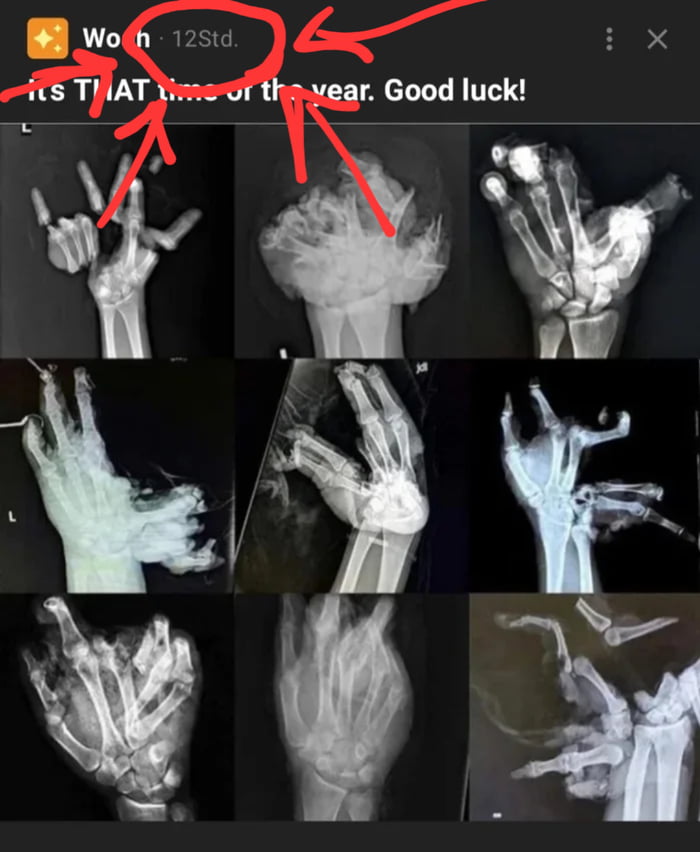 Can anyone tell me what this means please? - 9GAG