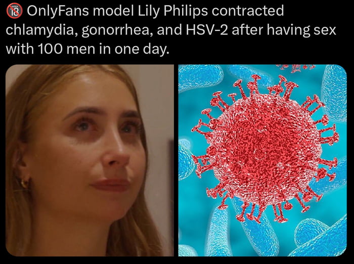 I'm sorry but what did you expect? - 9GAG