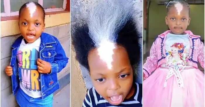 Baby with a unique birthmark - 9GAG