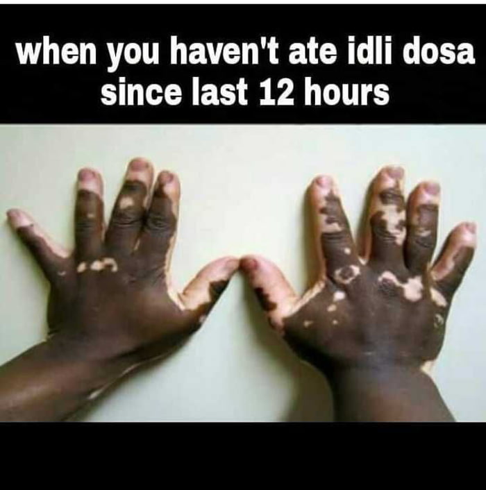 *le andu gundu people be like - 9GAG