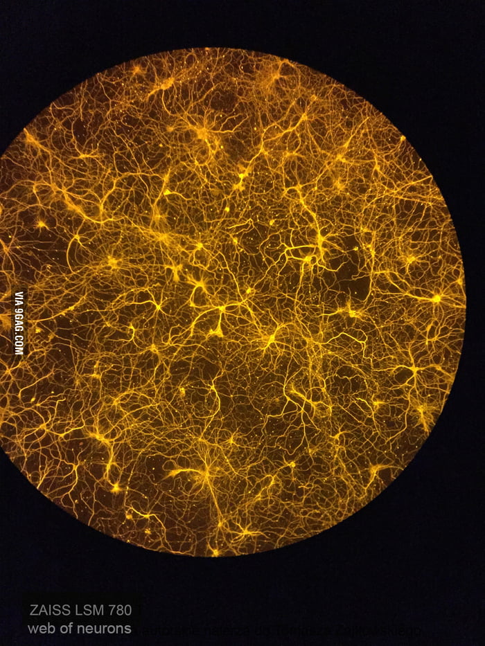Web of nerve cells - real microscopy photo - 9GAG
