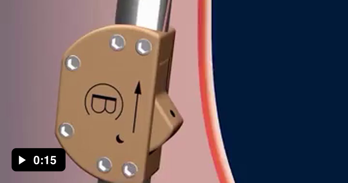 German Inventor Clemens Bimek Created a Sperm Switch That Lets Men ...