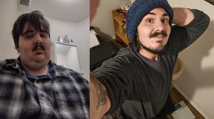 222 lbs (101 kilos) lost. Gastric Sleeve, constant work, and emotional ...