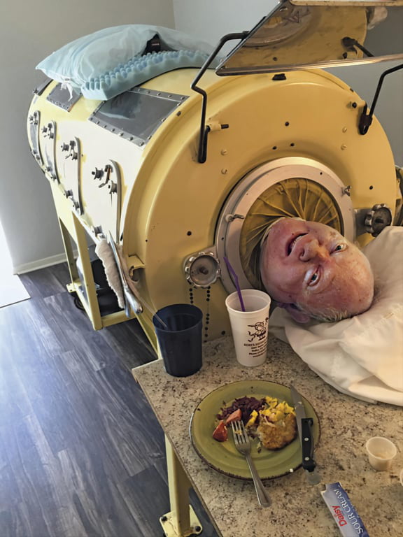 One of the last People to live in an Iron Lung. At 6 years old ...