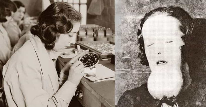 Radium Jaw In The Early Part Of Last Century Watch Dials hand Were radium-jaw-in-the-early-part-of-last-century-watch-dials-hand-were