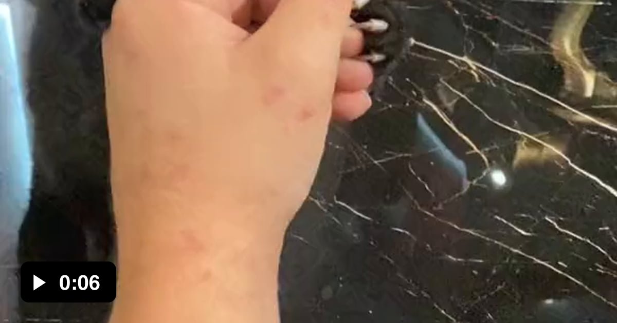 Dude’s hand has so many cute scars. - 9GAG