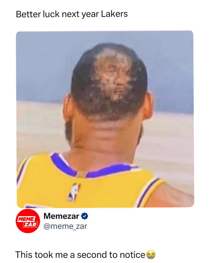 When the bald spot becomes the MVP - 9GAG