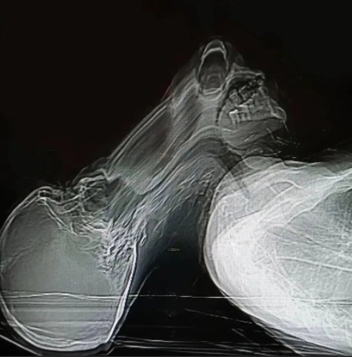 Sitting up during an CT Scan - 9GAG