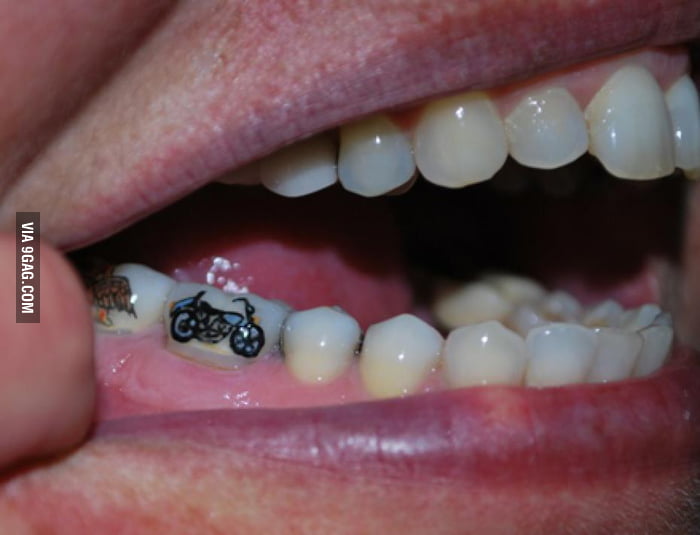 So teeth tattoos are now a thing... - 9GAG