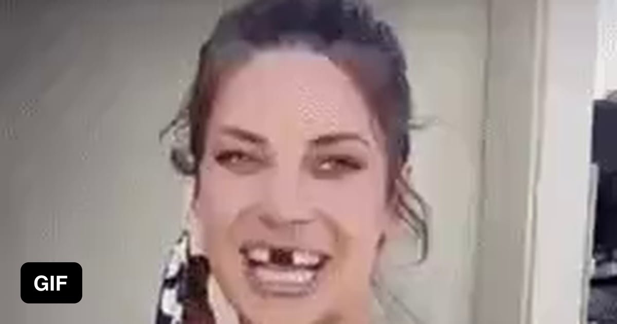 Teeth mate.. - 9GAG