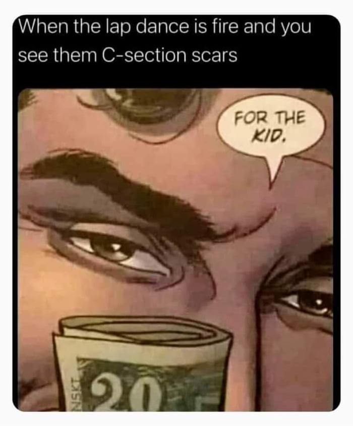 Tramp stamp, stretch marks & a c-section scar - 9GAG