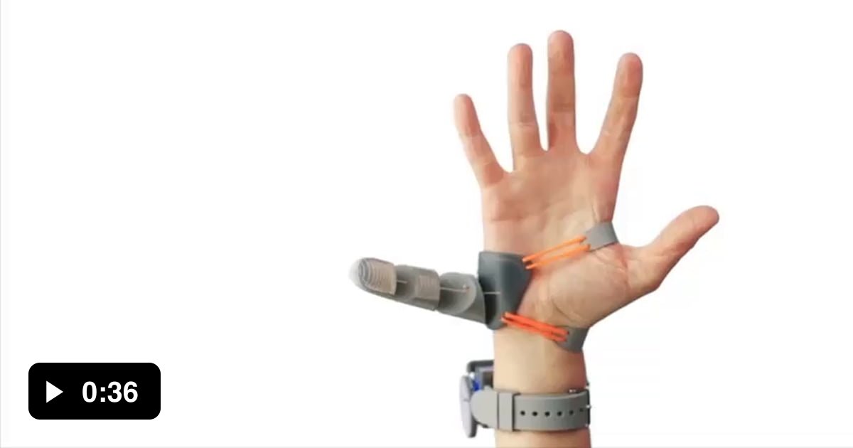 The 6th finger was created by bioengineers from Cambridge for ...