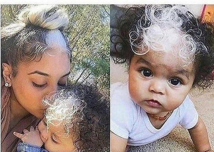 The baby inherited this " rare birthmark" from her mom. - 9GAG